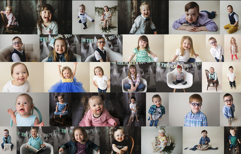 World Down Syndrome Day: Awareness, Inclusion & Activities